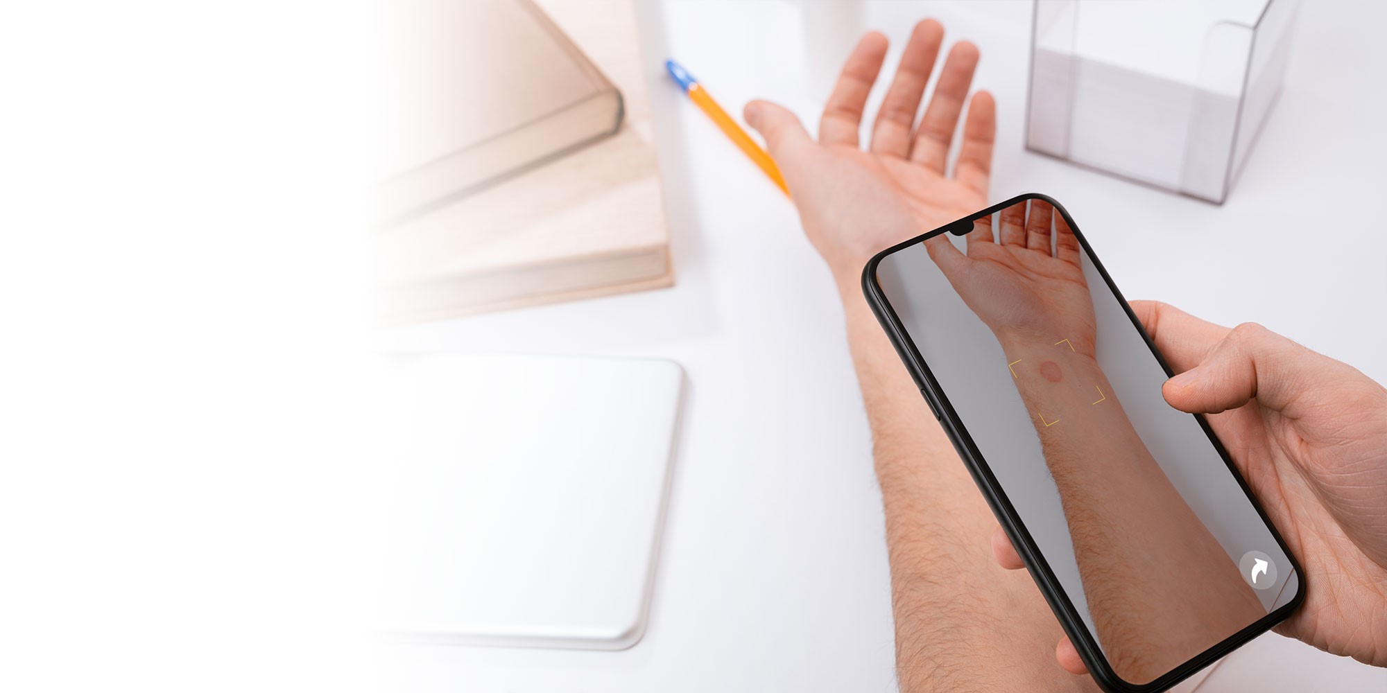 Hautproblem? Jetzt Hautarzt online fragen | Medgate